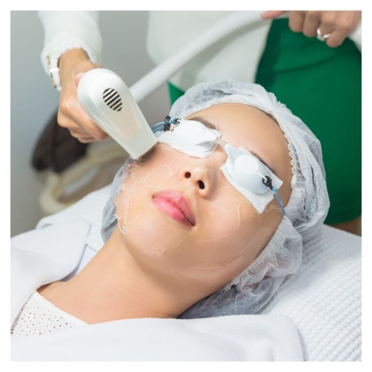 Top 4 Benefits of IPL for Age Spot Reduction - K2 Dermatology